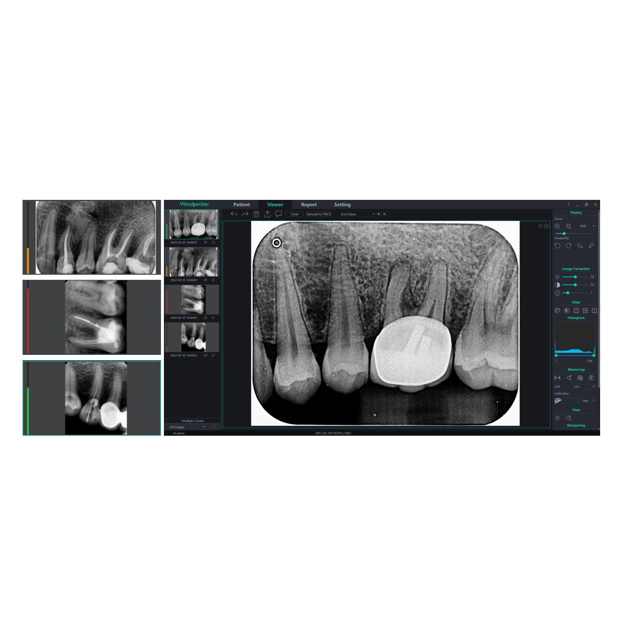 اسکنر فسفرپلیت وودپکر Woodpecker مدل Free Scan